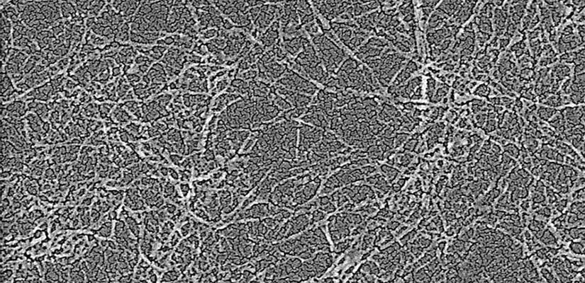 Biomimetic Composites: Mother Nature as a Muse